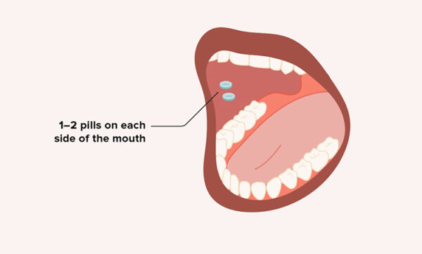 Everything You Need to Know About Drug Delivery System – AIPAK
