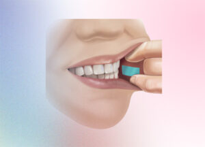 Oral Film: The Complete FAQ Guide In 2025 – AIPAK