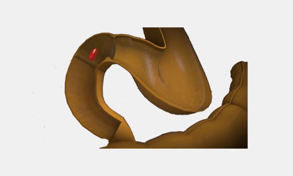 How To Make Softgels? – AIPAK